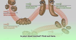 Understanding and Managing Moderate Stool Burden - The Green Grid
