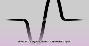 Sine Wave ECG: Identification and Treatment of Hyperkalemia - The Green Grid