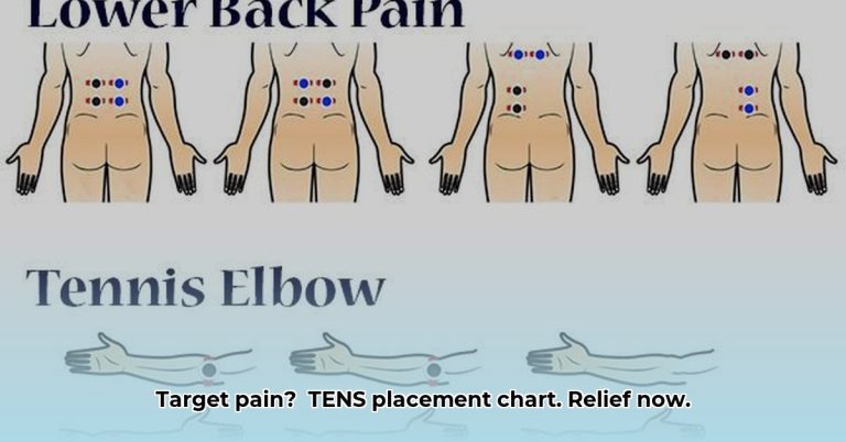 TENS Electrode Placement Chart (PDF): Your Guide to Effective Pain Relief - The Green Grid