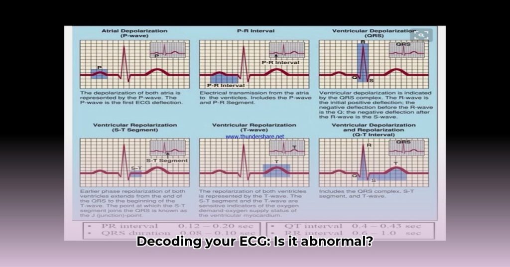 What Does Abnormal ECG Mean: Understand Your Results - The Green Grid