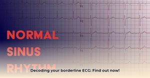 What is Borderline ECG? Understand Your Results Now - The Green Grid